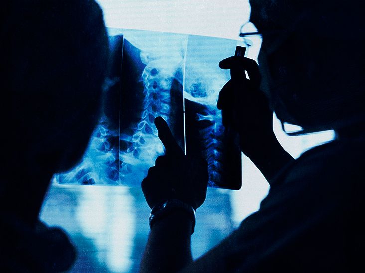 What are lytic lesions and how do they relate to multiple myeloma?