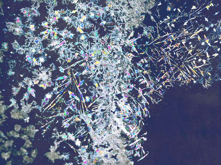 Low sodium levels (hyponatremia): Symptoms and causes