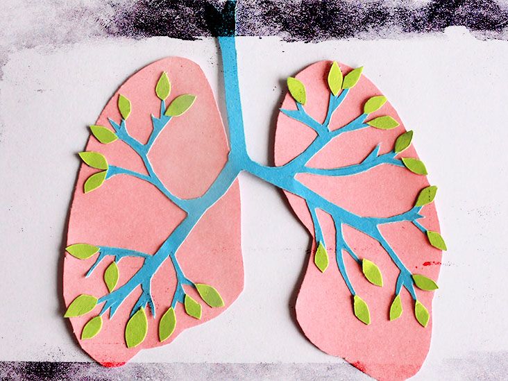 Advanced emphysema: Stage 4 symptoms and treatment