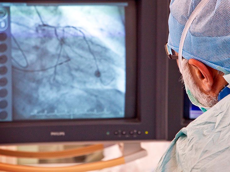 Coronary artery dissection: Symptoms, causes, and treatment