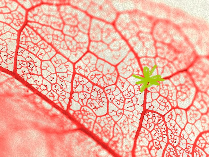 Anomalous coronary artery: Causes, symptoms, diagnosis, and more