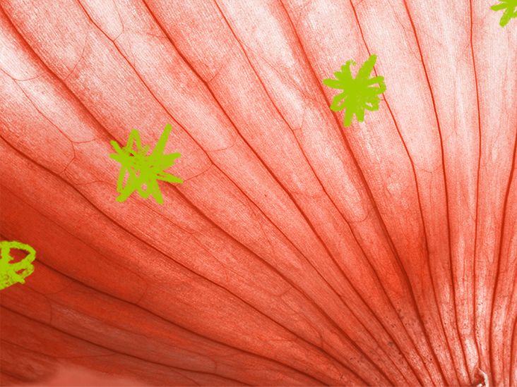 Pulmonary infarction: Symptoms, causes, and treatment