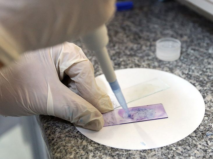 Biopsy 5 Things Every Patient Should Know Different Types Of Lung ...