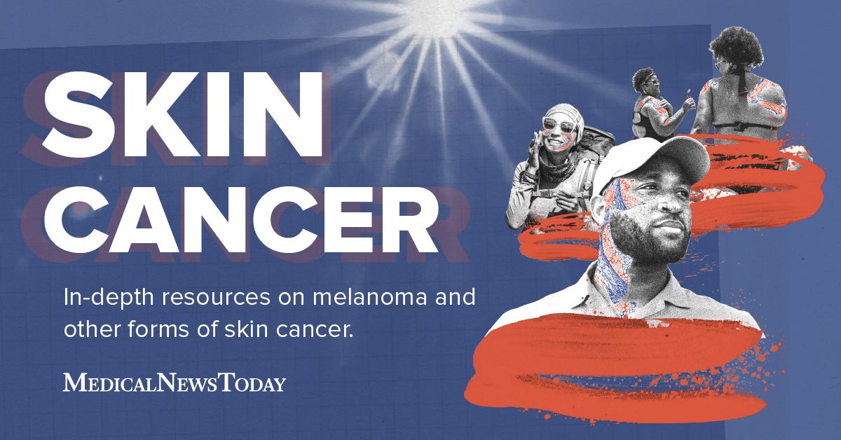 Skin cancer: Resources on symptoms, treatment, and more