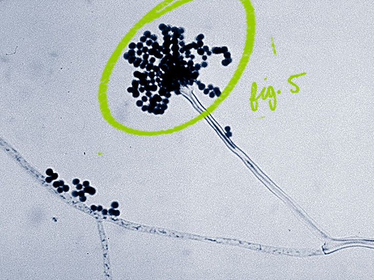 Drug resistance: Common type of mold could infect people's lungs