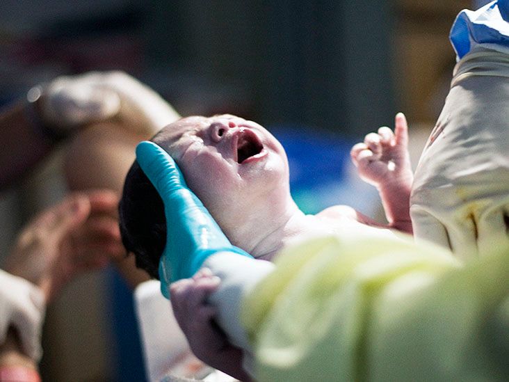 Heart failure in infants: Signs, causes, and treatment