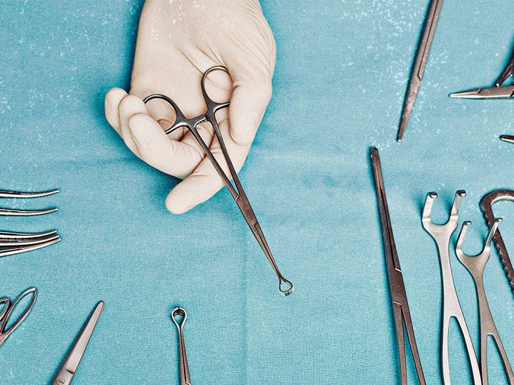 Trigger finger surgery: Recovery time and outlook