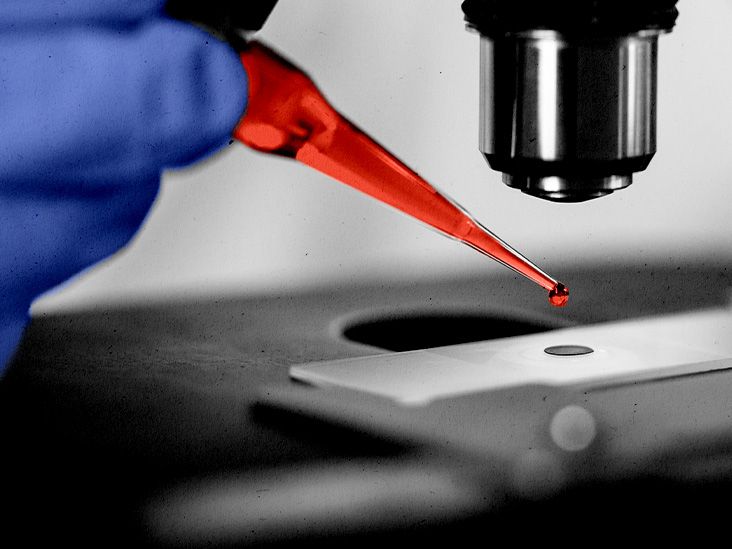 Leukemia: Causes, treatment, and early signs