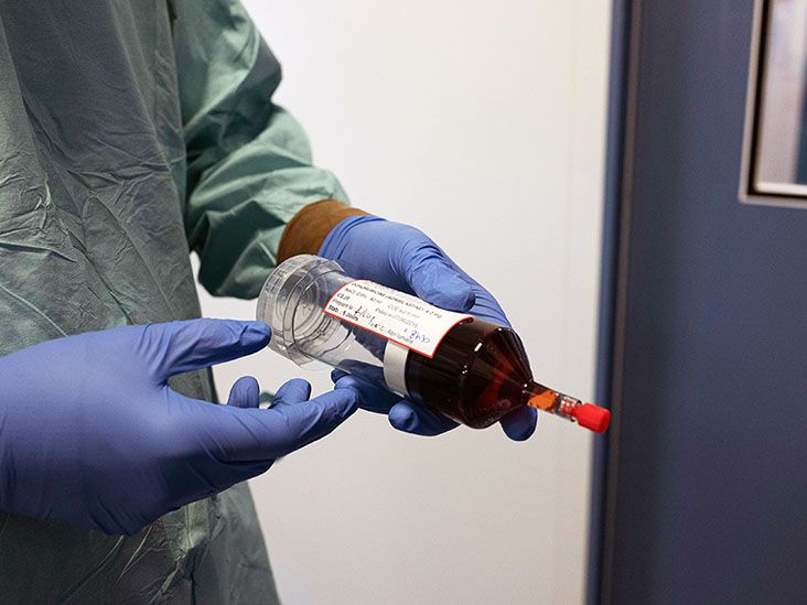 Intraperitoneal chemotherapy: Procedure and side effects