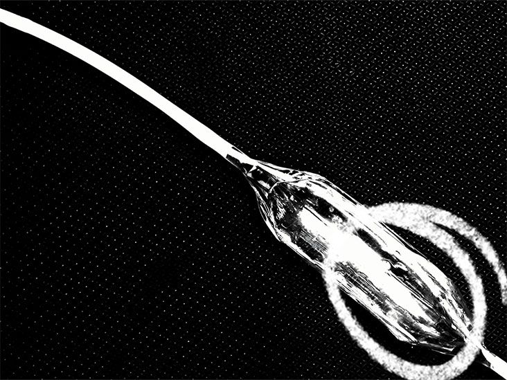 PCI for heart disease: Risks, benefits, results, and more