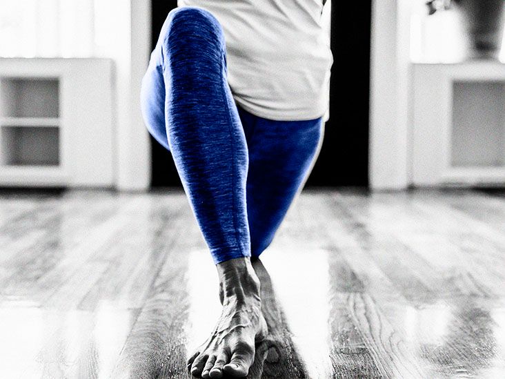 Post thrombotic syndrome: Causes, symptoms, and treatment