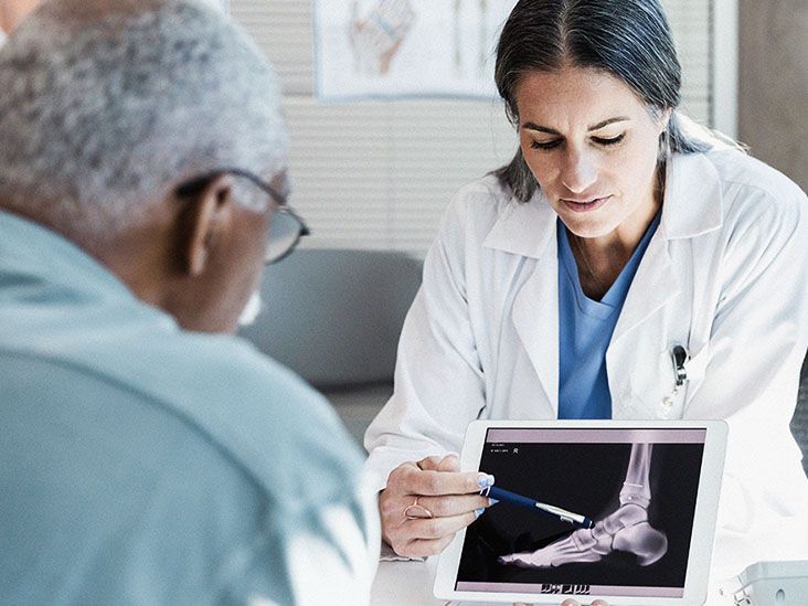 Rheumatoid arthritis pictures: A visual guide