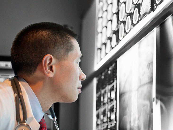 Teratoma: Types, symptoms, and causes