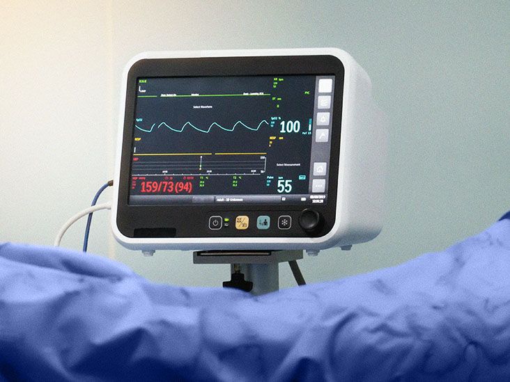 MINOCA heart attack: Definition and types