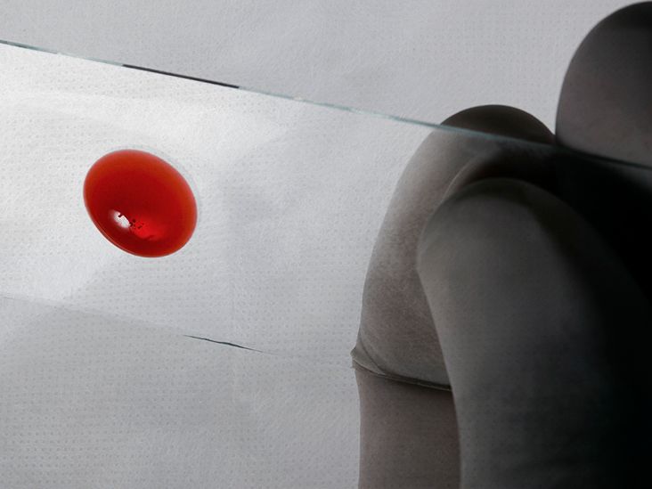 Shock liver: Symptoms, treatment, and outlook