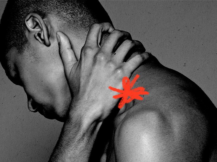 Brachial plexus injury: Causes, diagnosis, treatment, and more