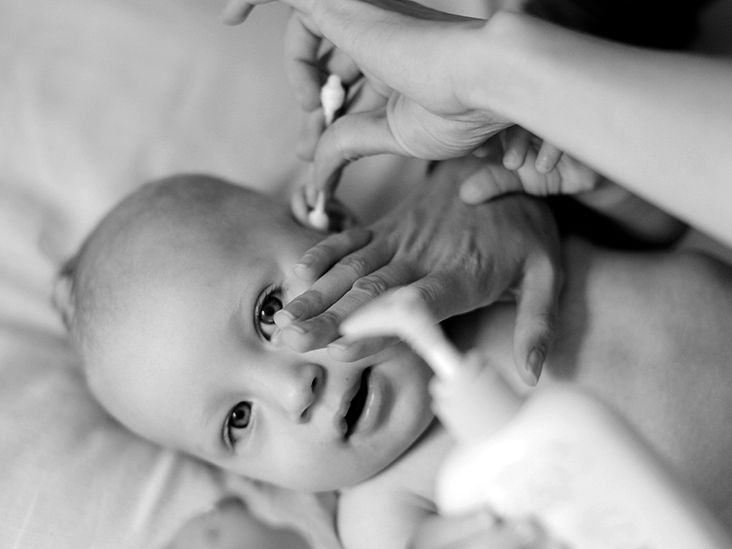 Ear eczema: Symptoms, causes, and treatment