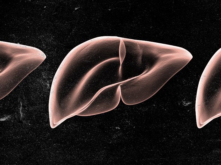 Artificial liver: What is it and can it treat liver disease?