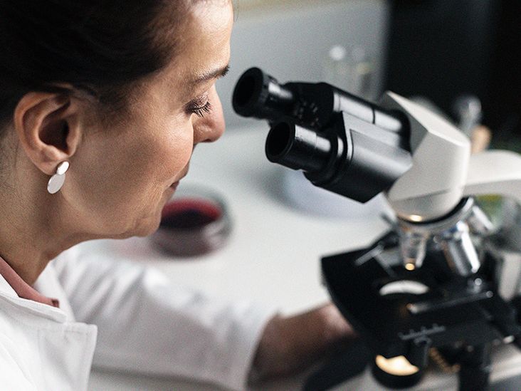 Calciphylaxis: Symptoms, causes, and treatment