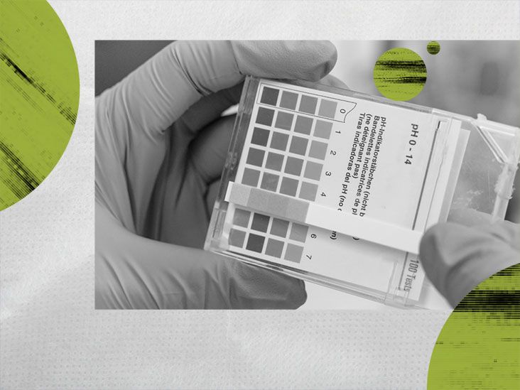 Metabolic alkalosis: Causes, symptoms, and treatment