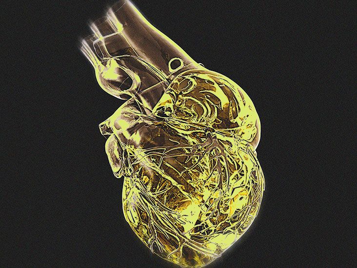 Total artificial heart: How it works, procedure, and more