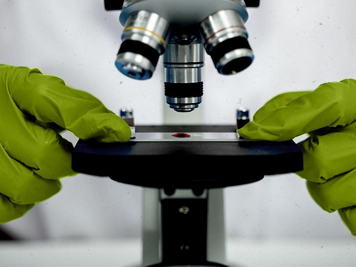 Cancer antigen 125 test: What is it, and what do the results mean?