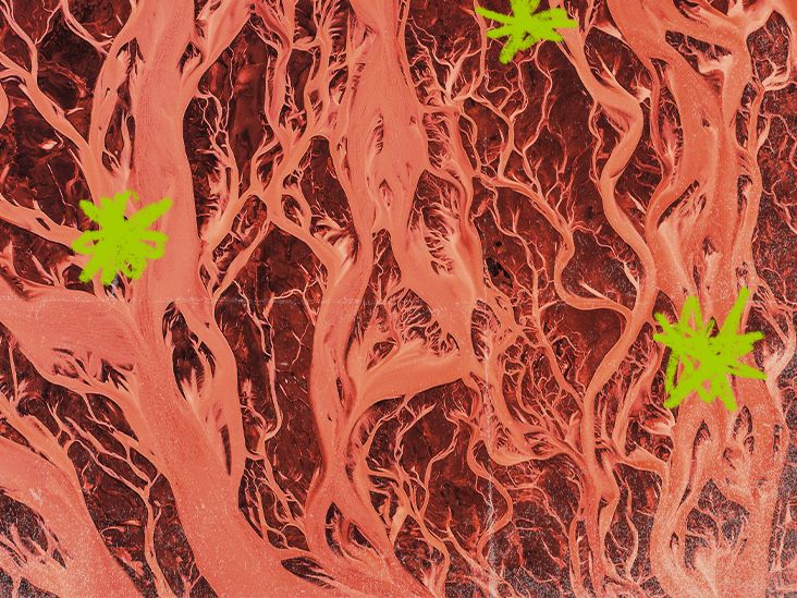 Macrovascular complications of diabetes: What are they?