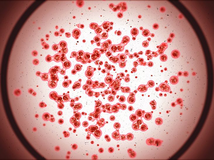 Leukemia Cancer Cells