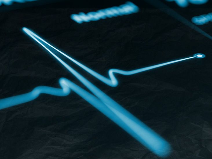 Left bundle branch block: Symptoms, causes, and treatment