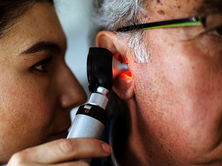 Sensorineural hearing loss: Types, causes, and treatment