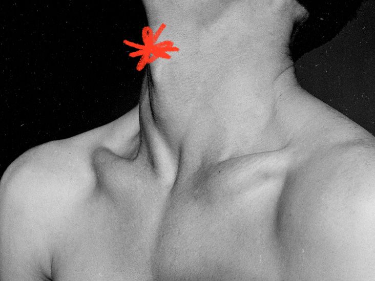 Throat contusion: What to know