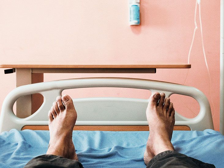 Candida auris: All about the drug-resistant superbug fungus