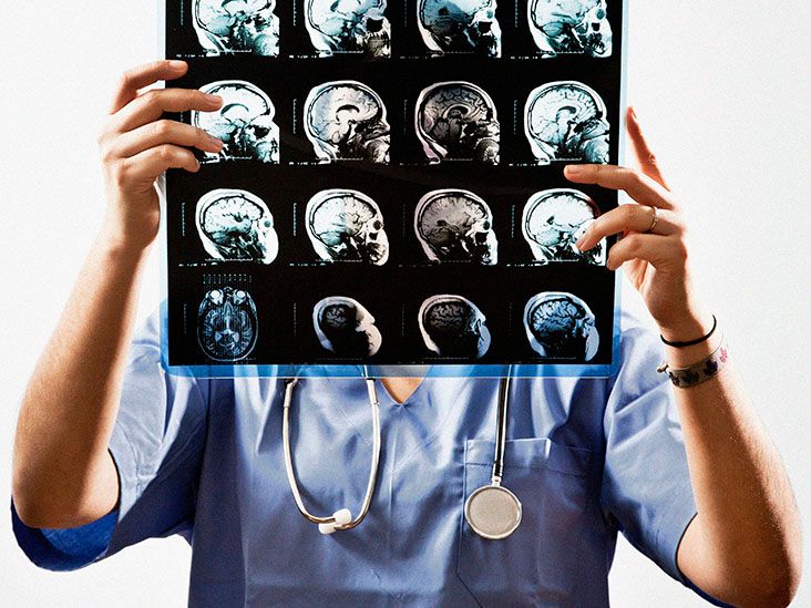 Cerebellar stroke: Symptoms, prognosis, treatment, and more