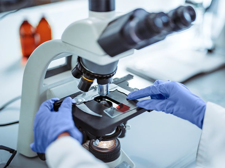 Macrocytic anemia: Causes, symptoms, treatment, and types