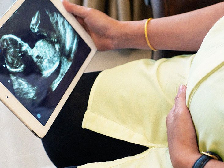 Uterus didelphys (double uterus): Symptoms and more