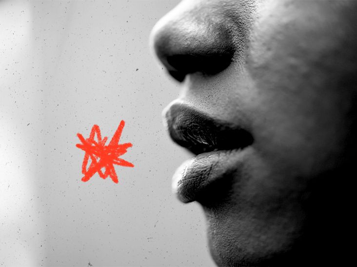 Expressive aphasia: Symptoms, causes, and treatment