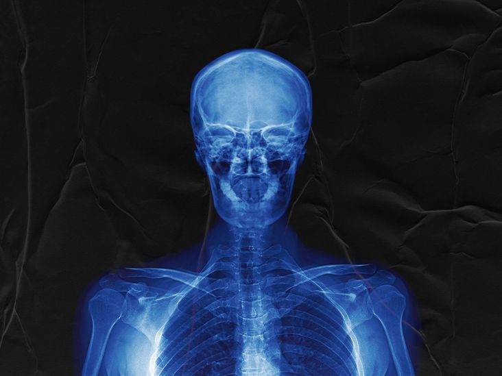 Hydroxyapatite: What is its function in bone?