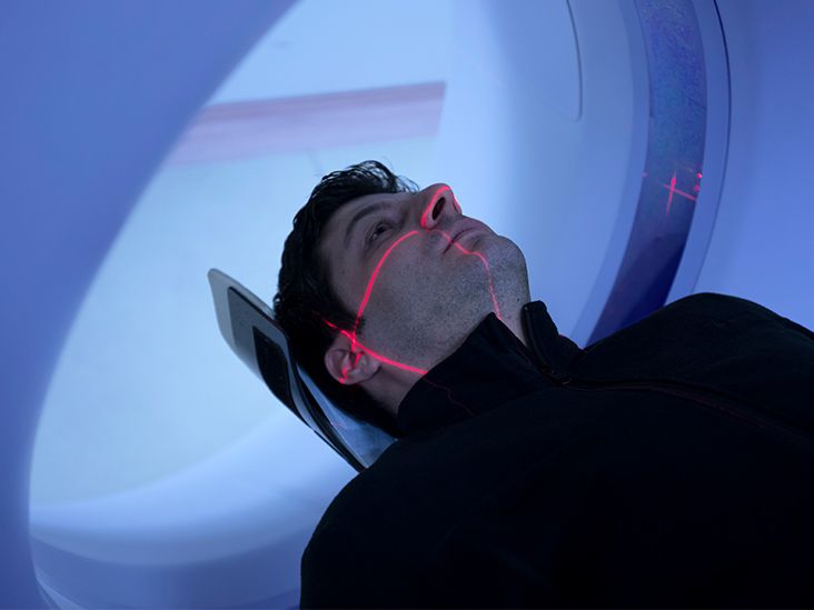 Diffuse axonal injury: Symptoms, grading, and recovery