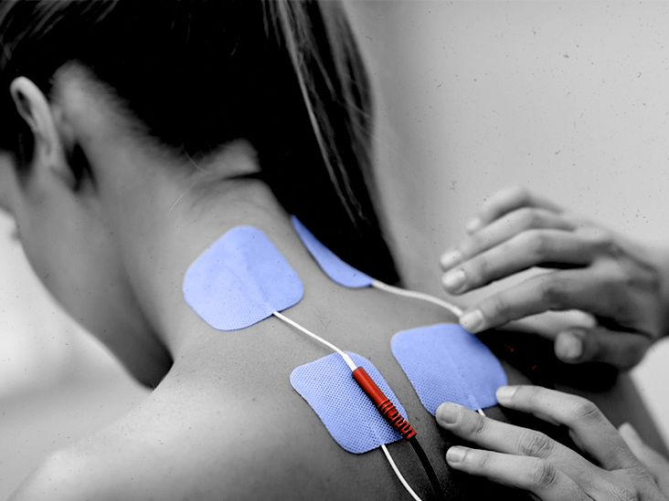 Somatosensory evoked potential (SEP) test: What to know