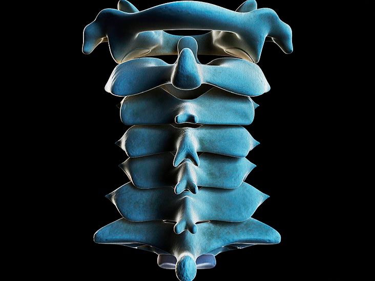 Cervical spinal stenosis: Symptoms, treatment, and exercises