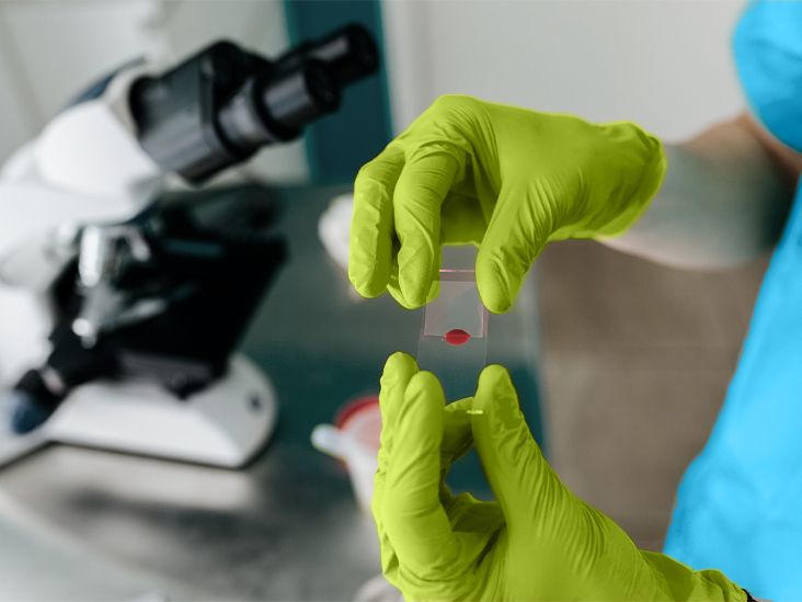 Thyroid antibody blood test (TgAb): What to know about the results