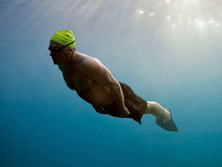 Bone-on-bone arthritis: What it is, symptoms, and treatment