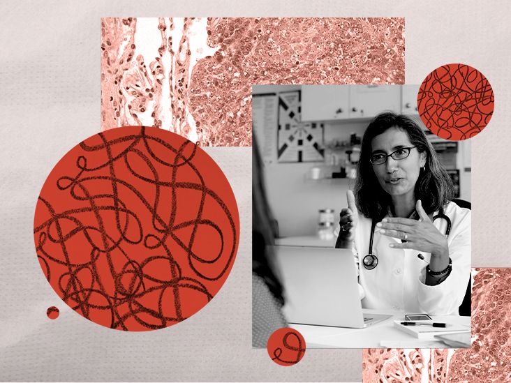 Ewing sarcoma: Stage 4 symptoms and more