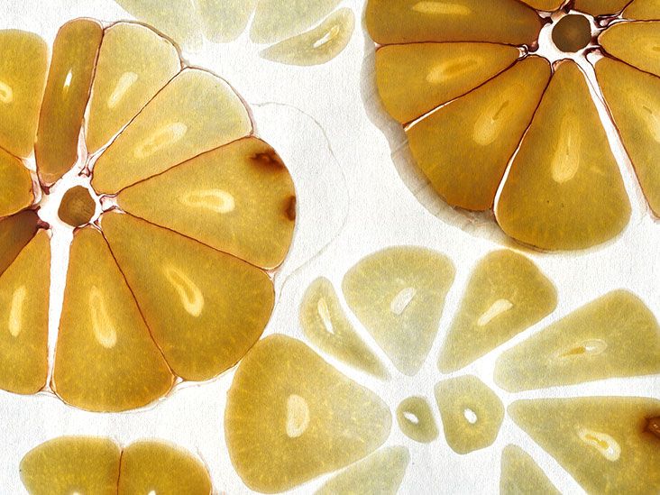 Does garlic lower cholesterol?