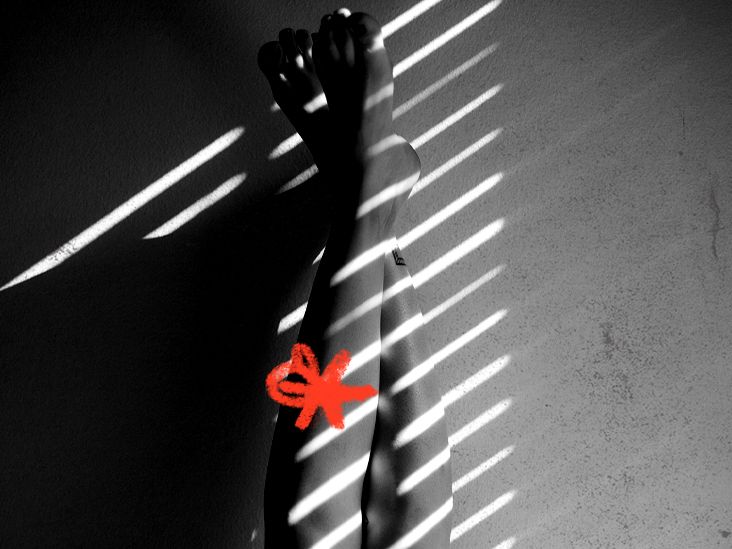 Maisonneuve fracture: Anatomy, treatment, and recovery