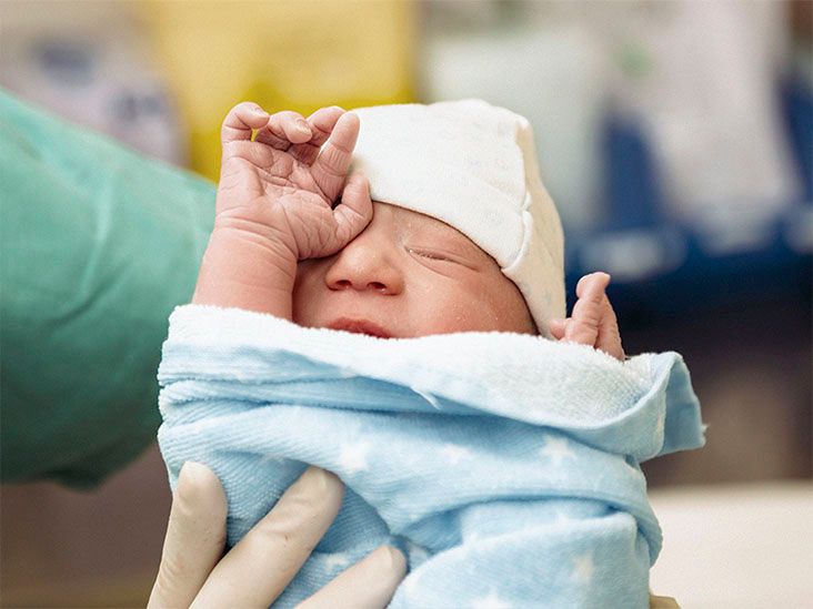 Arthrogryposis: Symptoms and life expectancy