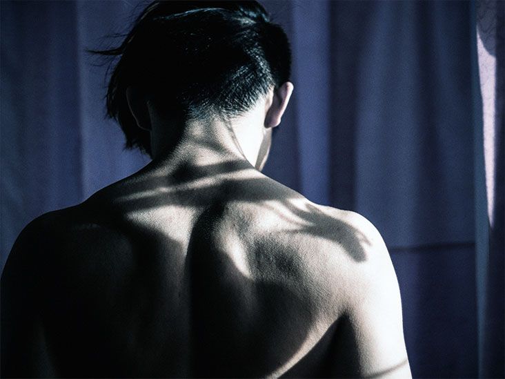 Psoriasis on the back: Symptoms, causes, diagnosis, treatment