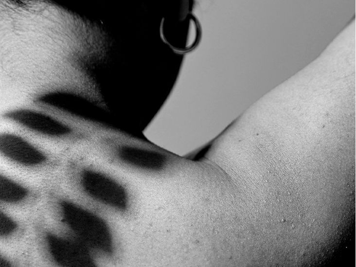 Soft tissue sarcoma in the shoulder: What to know