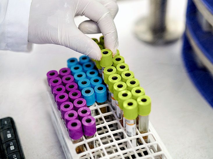 Eosinophil count: Test and results