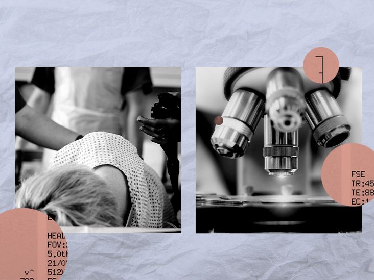 Ulcerative colitis vs. microscopic colitis: Differences and more